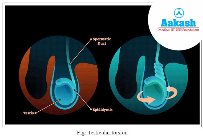Testes: Male Reproductive System, Male Primary Sex Organ, Structure and ...