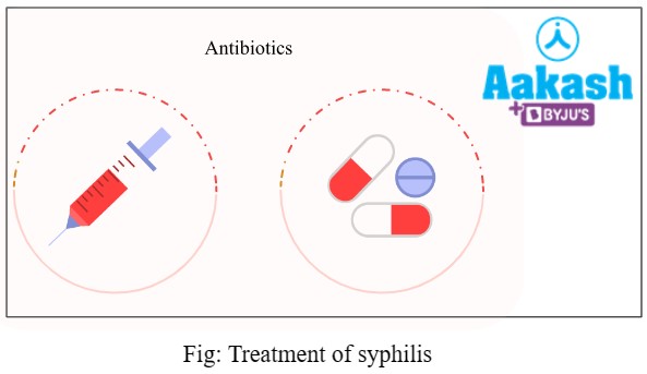 Syphilis: Causative Agent, Symptoms, Diagnosis, Treatment and ...