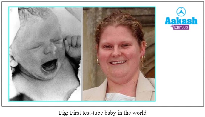 IVF: Meaning, Treatment, Steps & Significance | AESL