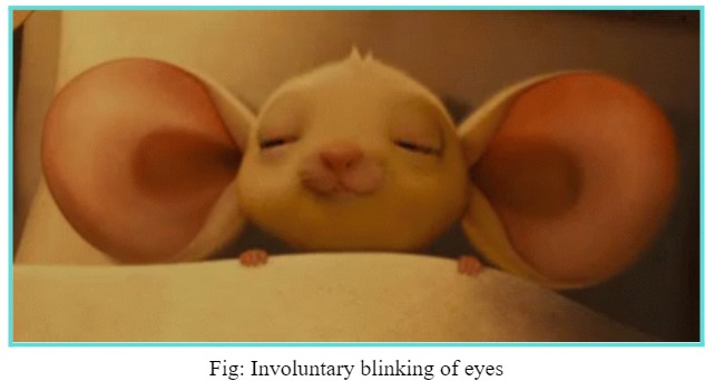 Reflex Action Definition Types And Parts Of The Reflex Arc Aesl