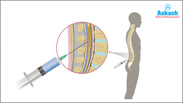 Spinal Cord: Structure, Anatomy, Functions, Injuries, Common Disorders ...