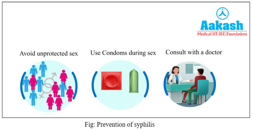 Syphilis: Causative Agent, Symptoms, Diagnosis, Treatment and ...