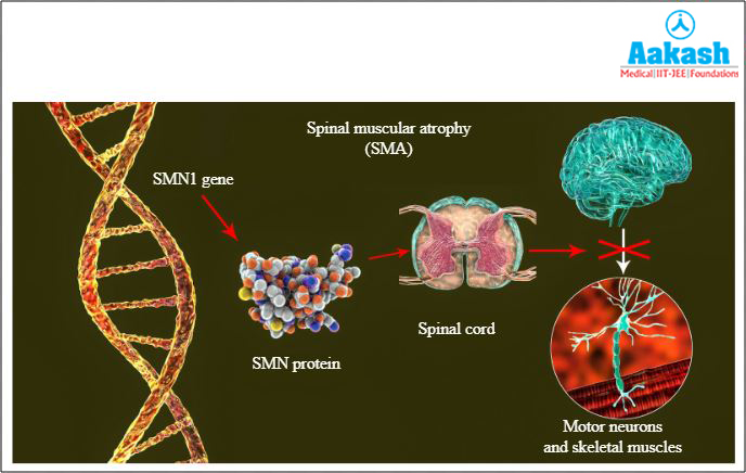 Spinal Cord: Structure, Anatomy, Functions, Injuries, Common Disorders ...