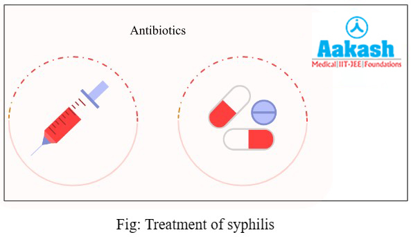 Syphilis: Causative Agent, Symptoms, Diagnosis, Treatment and ...