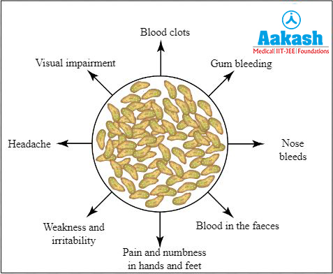 Platelets: Thrombopoeisis, Shape and Size, Mechanism of Blood Clotting ...