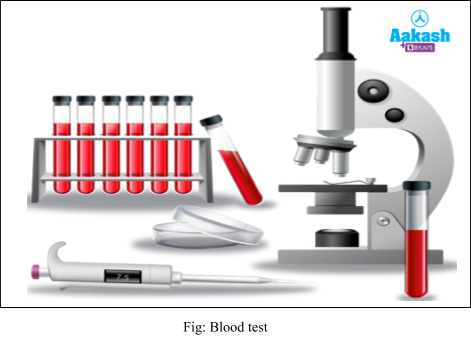 Blood Group Types, Erythroblastosis foetalis, Antigens and Antibodies ...