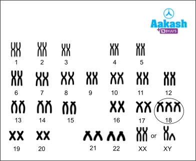 Chromosomal Disorders: Types, Symptoms & Chromosomal Disorders ...
