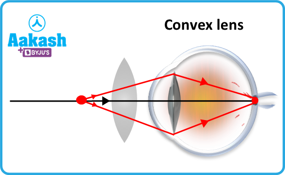 Human Eye: Defects, Apparent size, Accommodation & Correction | AESL