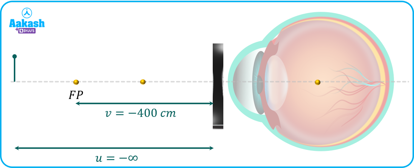 Human Eye: Defects, Apparent size, Accommodation & Correction | AESL