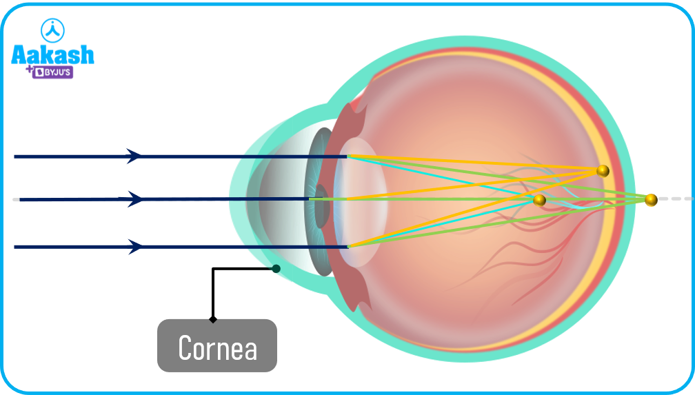 Human Eye: Defects, Apparent size, Accommodation & Correction | AESL