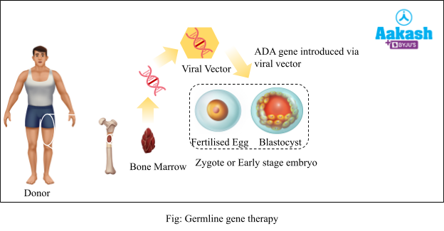 Gene Therapy Types, Genetically Engineered Insulin & Molecular ...