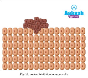 Cancer Causes, Treatment, Diagnosis, Types & Tumours Cells - Biology ...