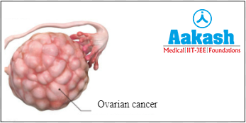 Ovaries: Function, Layers, Disorders & Neurovascular Supply | AESL